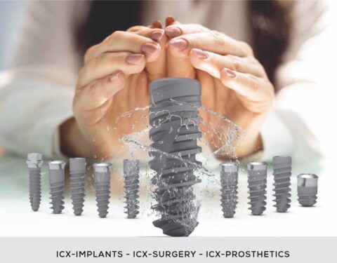 ICX implants - Dentalpoints blog